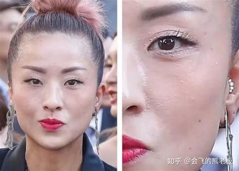 为什么就你的脸上容易长斑？ 知乎