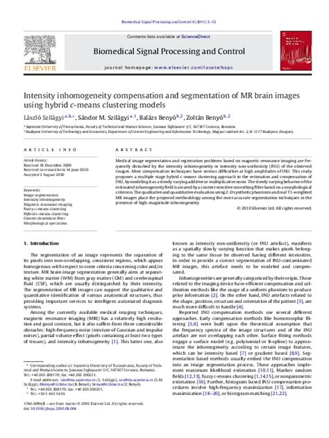 pdf intensity inhomogeneity compensation and segmentation of mr brain