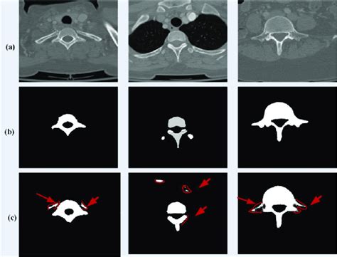Poor Segmentation Results A Input Images B Ground Truth And C