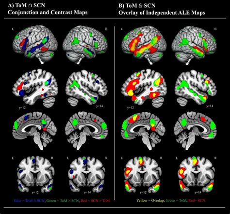Common And Differential Activation For Tom N113 And Scn N 211
