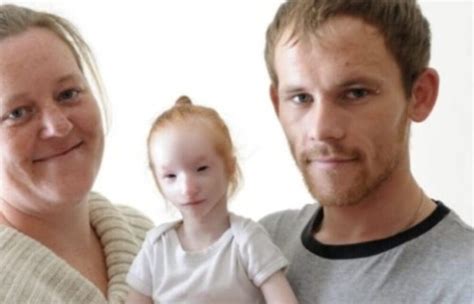 “woog Ongeveer 2 Pond” Het Kleinste Meisje Ter Wereld Charlotte Garside Viert Haar 16e Verjaardag