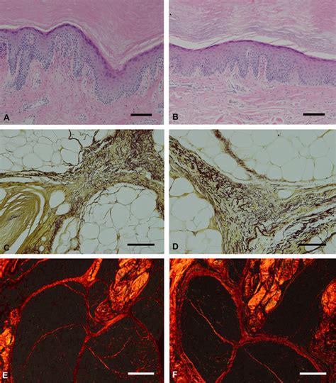 Histomorphometric Comparison After Fixation With Formaldehyde Or