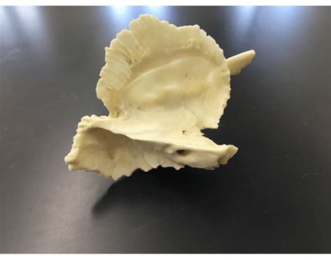 Endocranial Temporal Bone Quiz