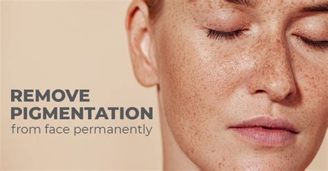 How To Remove Pigmentation From Face Permanently O2 Klinik Aesthetic