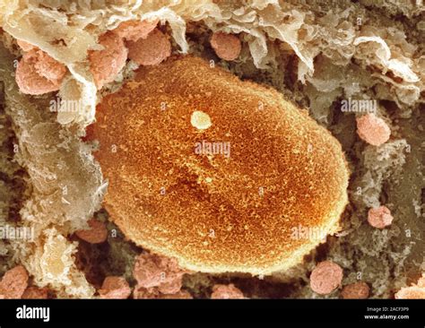 Cell Nucleus Coloured Scanning Electron Micrograph SEM Of A Section Through A Liver Cell