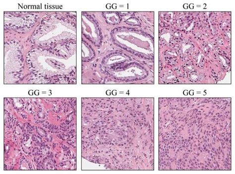 Filippo Molinari On Linkedin Impact Of Stain Normalization On