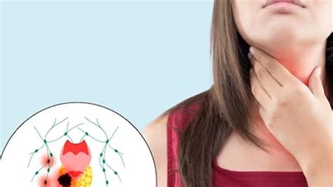 When Thyroid Messes With Sex Life A Guide To Healthy Sex Life Lifestyle News News18