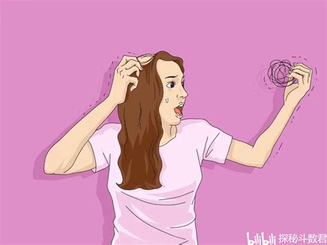 深圳肤康皮肤病专科：诱发女性脱发的因素？关注女性脱发健康 哔哩哔哩
