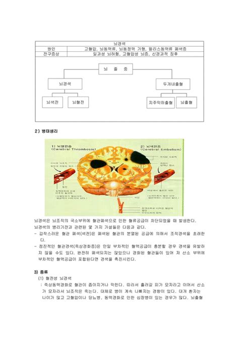 성인내과케이스 뇌경색 Cerebral Infarction Stroke 케이스 및 간호과정 의약학