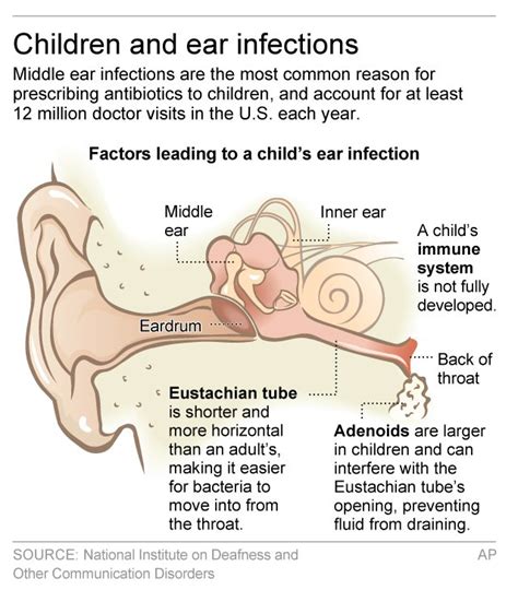 Ear Infection Antibiotics List For Adults Ghana Tips