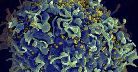 Womans Own Immune System Has Possibly Cured Her Of Hiv The Premier Daily