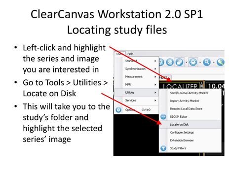 Ppt Clearcanvas Workstation 2 0 Sp1 Powerpoint Presentation Free Download Id 3997800