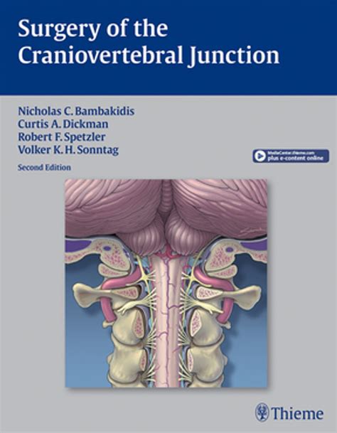 Surgery Of The Craniovertebral Junction Ebook By Epub Rakuten Kobo