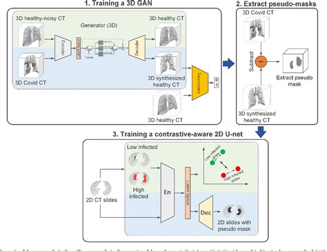 Figure From Self Supervised Region Aware Segmentation Of COVID CT Images Using D GAN And