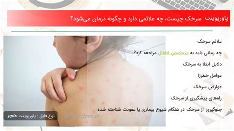 دانلود پاورپوینت سرخک چه چیزی است ، چه علائمی دارد و چطور درمان می‌شود