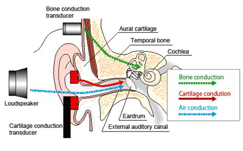 Hearing Aid Diagram