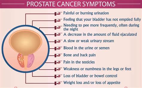 The Sick Truth Of Prostate Cancer Symptoms And Diagnostic