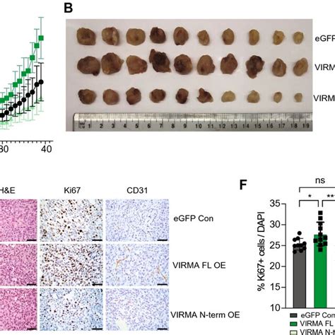 Overexpression Of Full Length Virma Promotes Growth Of Breast Cancer