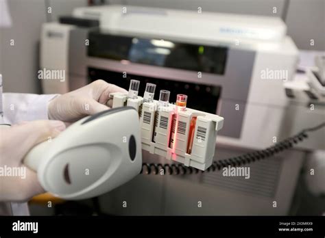Automated Analysis Chemiluminescence Barcode Reading Analysis