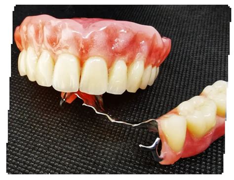 Chrome Dentures Bespoke Denture Clinic