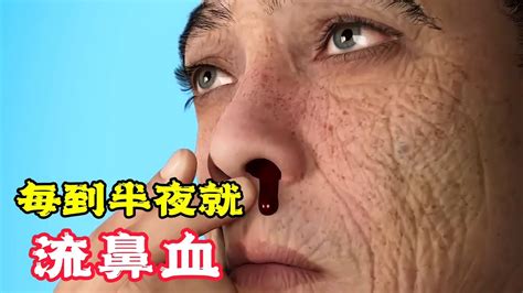 奇怪的女人，每晚半夜流鼻血，原因是鼻子裡長牙！科普動畫《鼻子裡長牙》。電影，短片，成精，解說，搞笑，動畫，動作，喜劇，獵奇，奇幻，腦洞，科幻