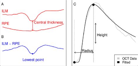 The Process Of Automatically Extracting Central Thickness Maximum