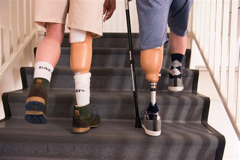 Revalidatie Na Amputatie ZorgSpectrum