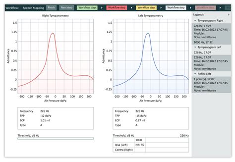 Type C Tympanogram Causes At Mickey Munos Blog