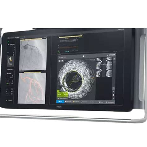 Buy Philips Intrasight Mobile 3 Echocardiogram Machine Online At Best Price