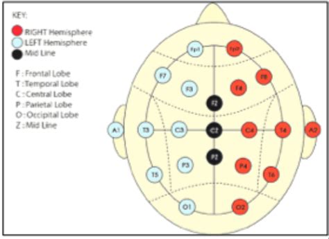 Eeg Video Flashcards Quizlet