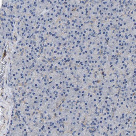 Rabbit Polyclonal Anti Cit Antibody Buy For Research Highly Specific Rigorously Validated