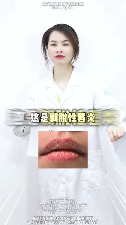 嘴唇干燥又起皮，别以为是小问题，医生教你趁早处理干燥 唇炎 润唇膏 科普 抖出健康知识宝藏 Youtube