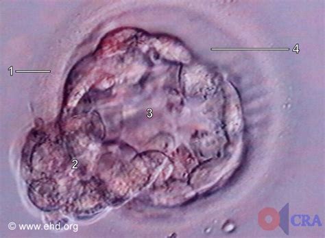 Blastocyst Hatching