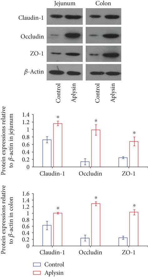 Expressions Of Tight Junction Related Proteins In Tissues Of The