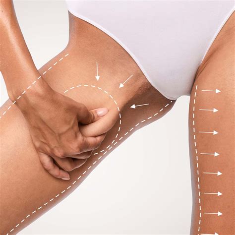 Thigh Lift Quality Life Health