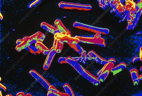 Clostridium Tetani Electron Micrograph