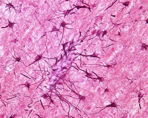 Astrocyte Art Pixels