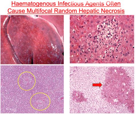 Hepatitis Cholangitis Cholangiohepatitis Flashcards Quizlet