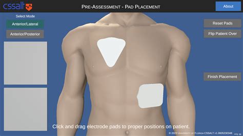 Cssalt Awarded Grant To Develop Online Defibrillator Simulation