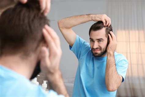 How To Recognise Treat And Prevent Male Pattern Baldness