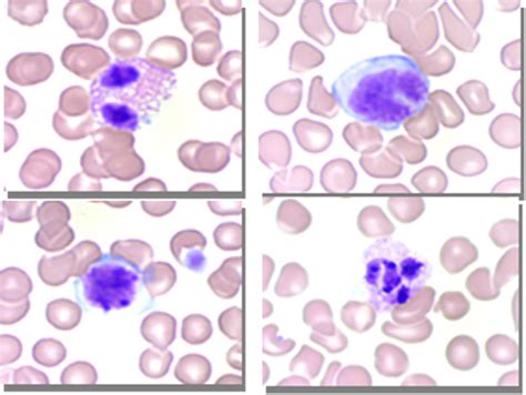 Quick Dip Differential Microbiologyhematology Stain Kit 1 Gallon