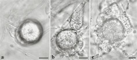 Pythium Nodosum Cuu 46 Ab An Antheridium Attached To Each