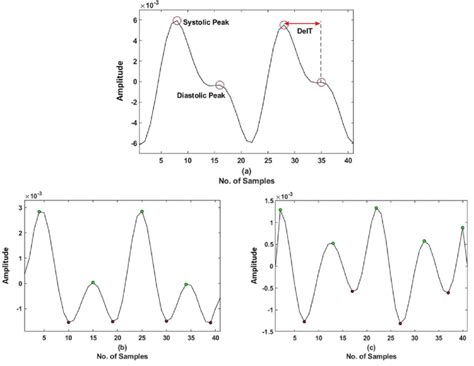 A A Representative Ppg Single Cycle Waveform With Systolic And Download Scientific Diagram