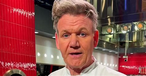 Gordon Ramsay Shares Horrific Injuries After Nearly Dying In Accident