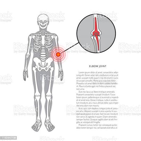 어깨 보 철물 텍스트를 위한 장소가 있는 벡터 배너 의료 일러스트 아픔에 대한 스톡 벡터 아트 및 기타 이미지 아픔 팔꿈치