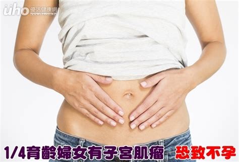 14育齡婦女有子宮肌瘤 恐致不孕uho優活健康網