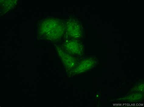 Syntenin 1 Polyclonal Antibody 22399 1 Ap