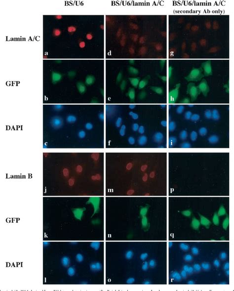 Figure 1 From A Dna Vector Based Rnai Technology To Suppress Gene