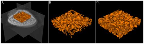 Representative Three Dimensional Micro Ct Scanning Images A A