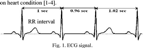 Figure 1 From Fractal And Multifractal Analysis Of Heart Rate